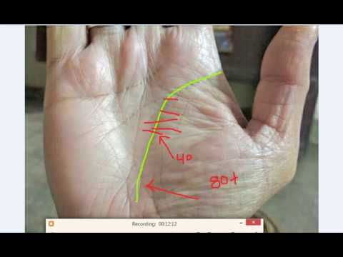 Medical Stigmata formation on Mercury Mount - YouTube