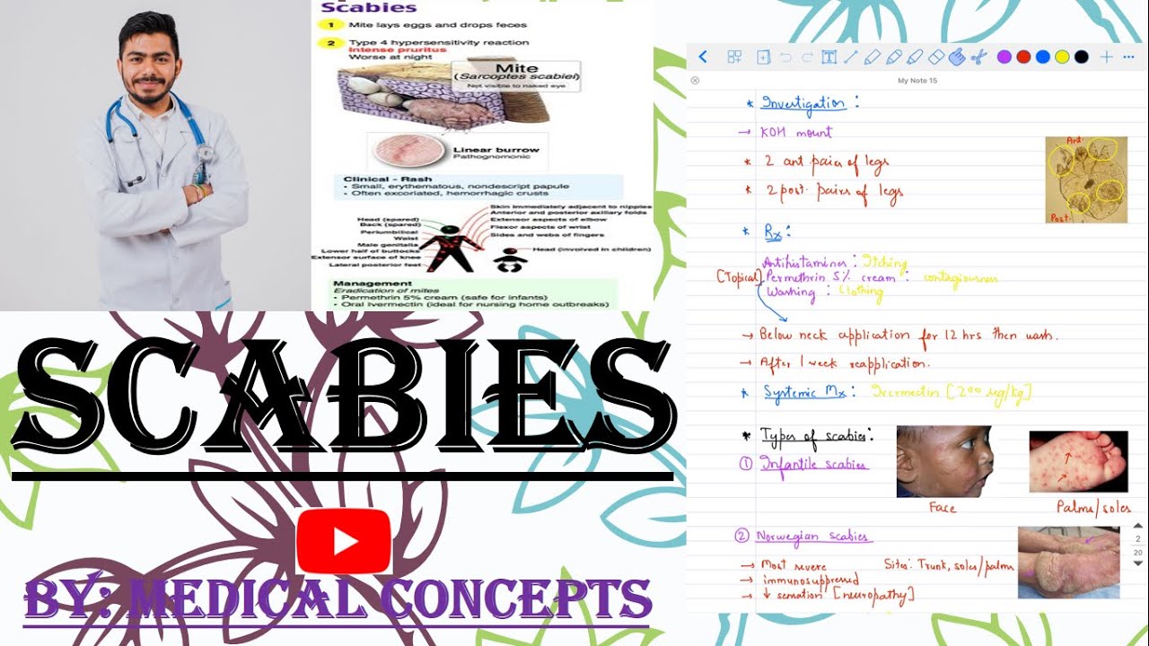 Scabies | Parasitic Infection | Dermatology - YouTube