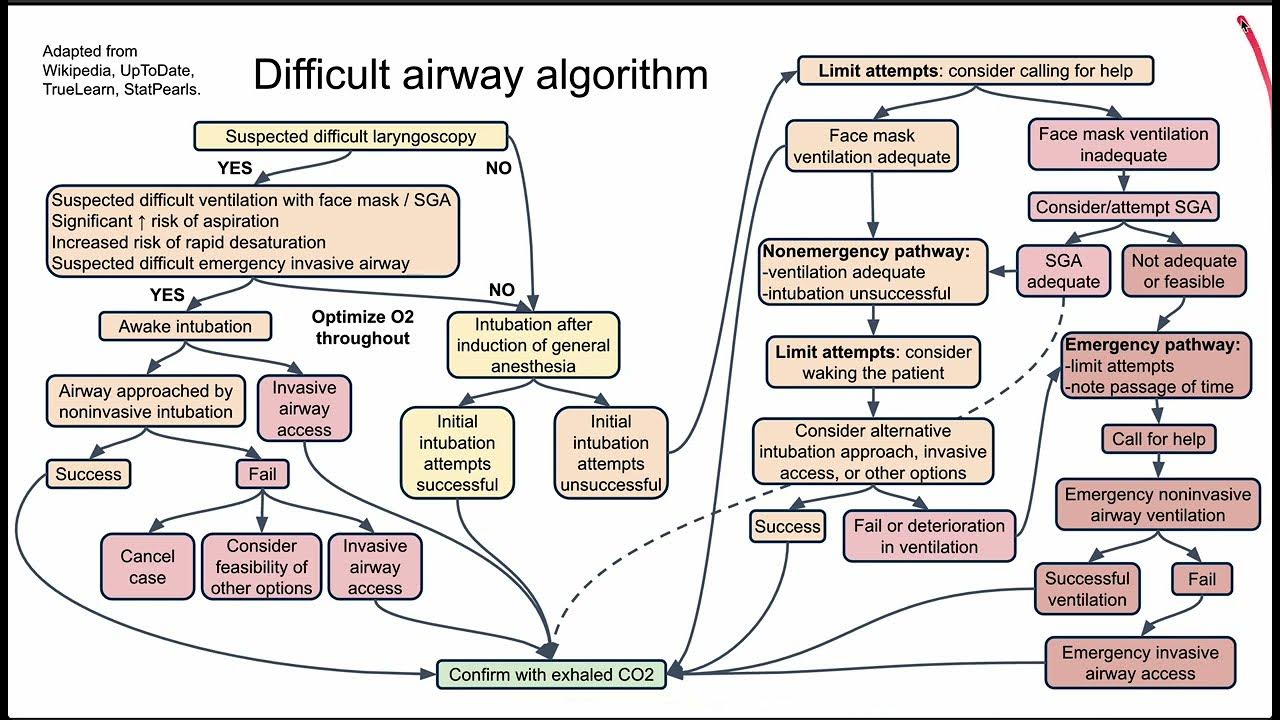 Difficult airway algorithm - YouTube