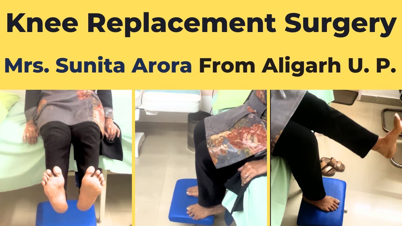 Knee Replacement Surgery- Patient Testimonial. (TKR/ Total knee ...