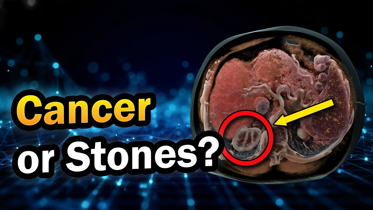 Abdominal & Pelvic CT Explained: Cancer, Appendicitis & Stones? - YouTube