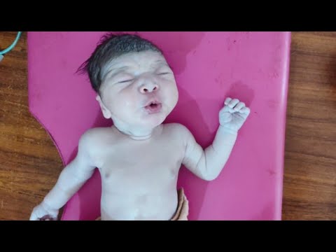 Cutest Newborn baby immediately after birth has adorable Pout ever 🥰 ...