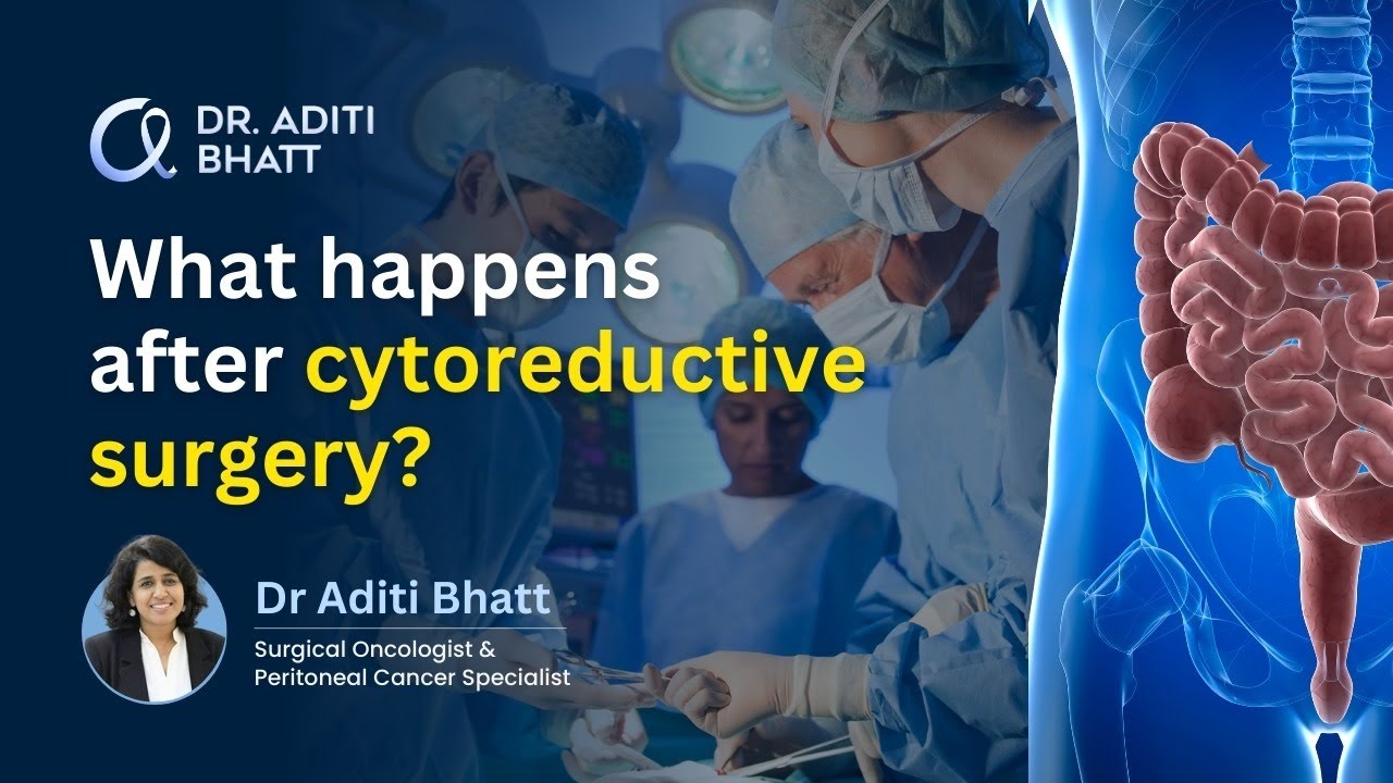 What happens after cytoreductive surgery? | What to Expect After ...