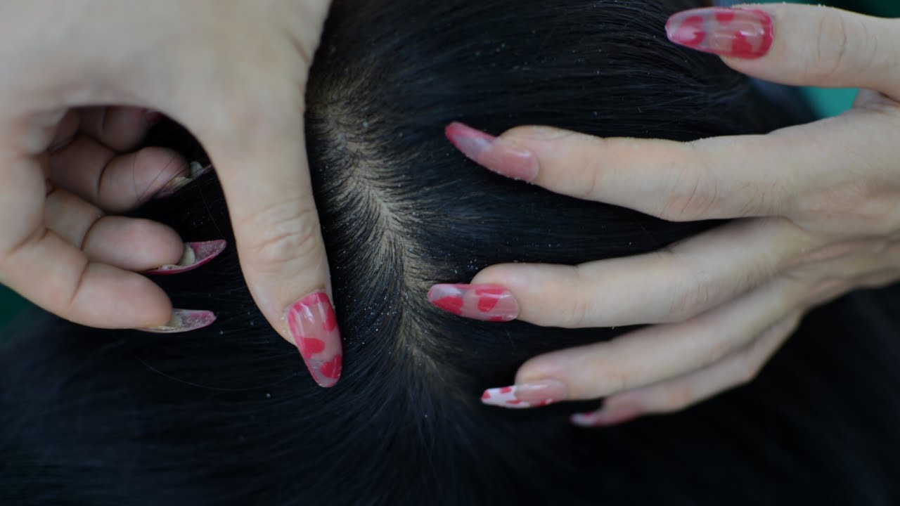 ASMR 1 Hour Scalp Scratching, Head Scratching With Long Nails Relaxing ...