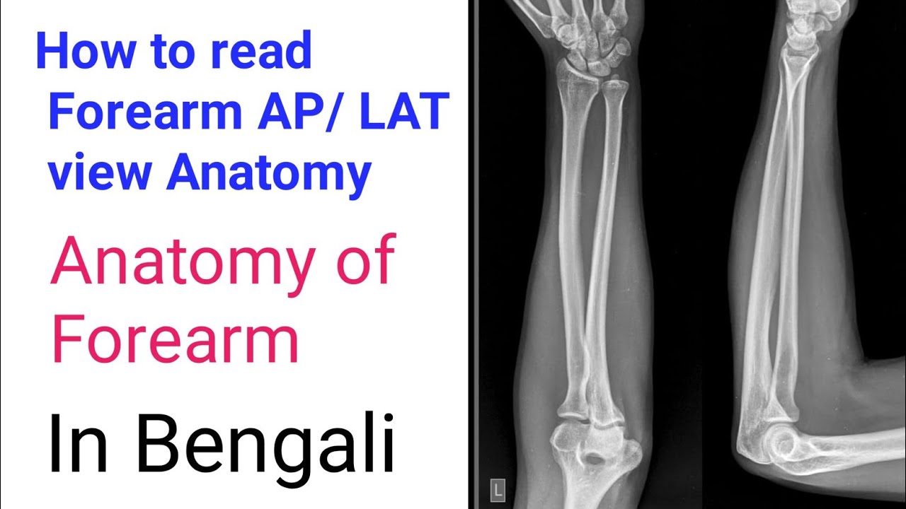 How to read X-Ray Forearm AP/ LAT View Anatomy ll Anatomy of Forearm in ...