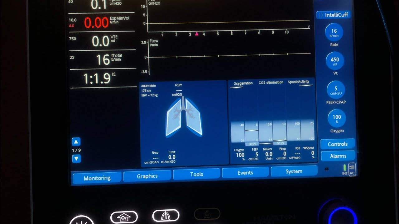 Basic Mechanical Ventilation | Dr. Taghreed | Misrata Medical Centre ...