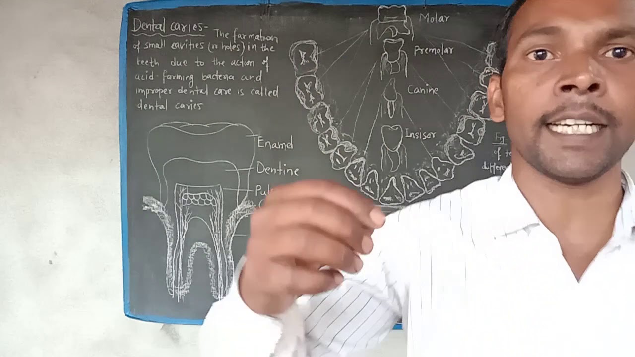 TEETH AND DENTAL CARRIES (CLASS 10TH - BIOLOGY )BY PRADEEP SIR - YouTube