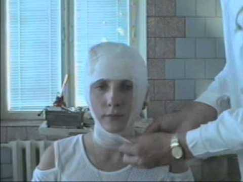 WRAP/ TAPING IN HEAD & NECK - YouTube