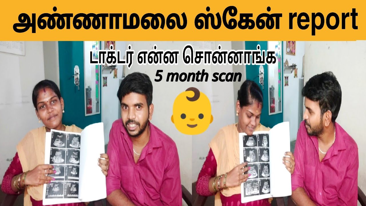 Anomaly scan report🤰| 5 month scan report pregnancy live test | vv ...