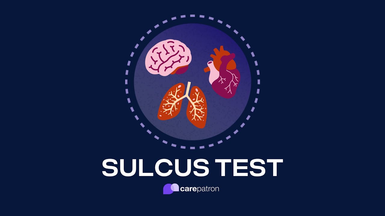 Sulcus Test - YouTube