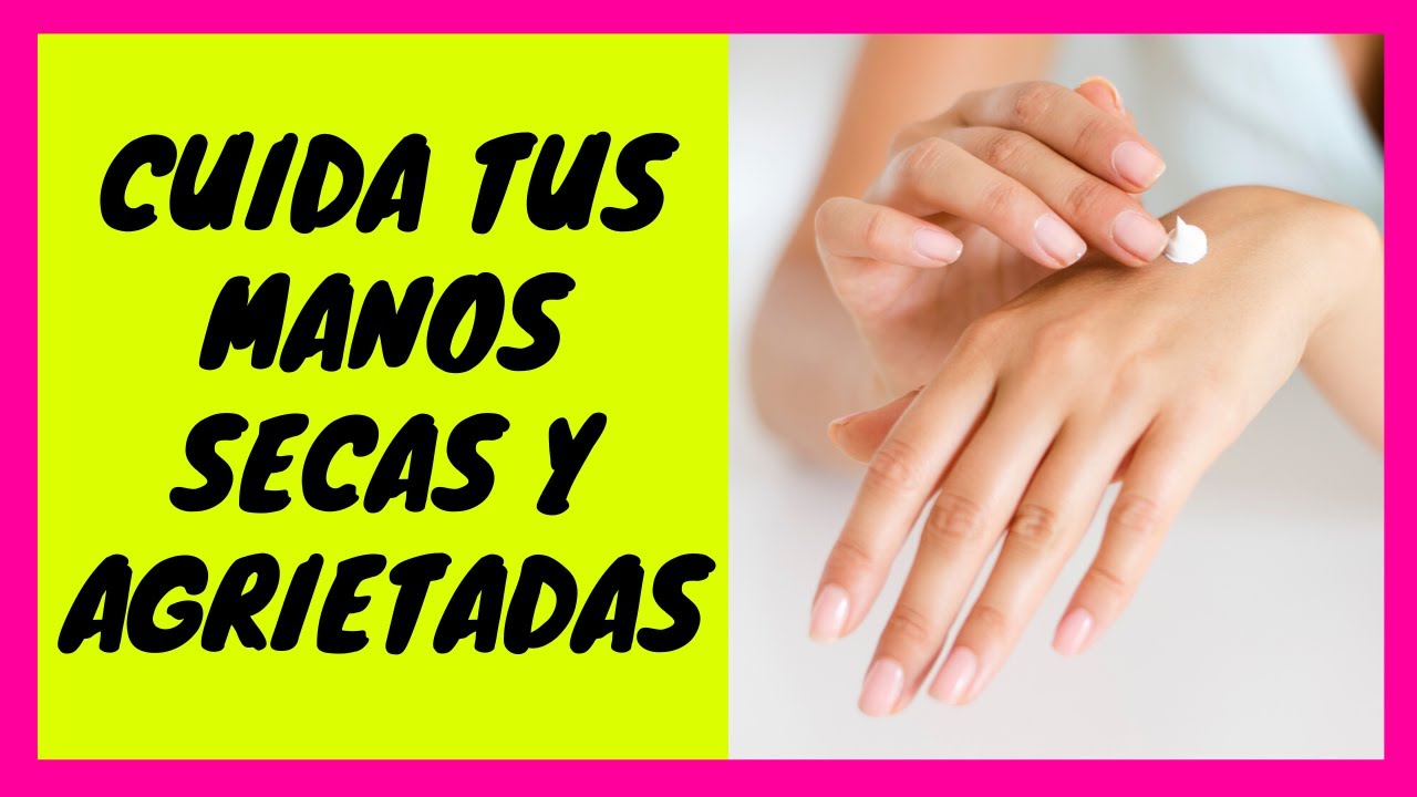 👐 Cómo CUIDAR e HIDRATAR tus MANOS SECAS y AGRIETADAS | Consejos que SI ...