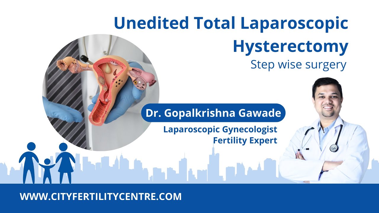 Unedited video of step-wise surgery of Total Laparoscopic Hysterectomy ...
