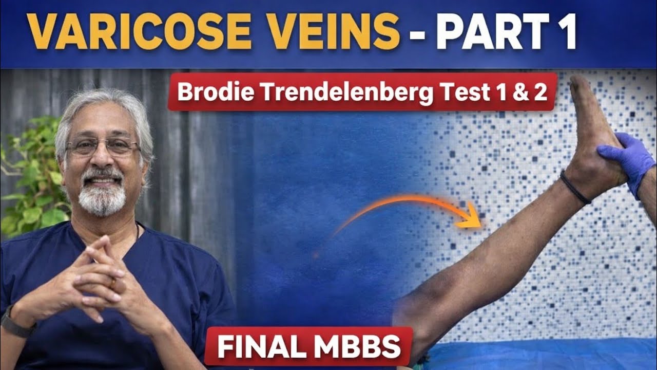 Varicose Veins - Part I: Trendelenburg Test I & II – Step-by-Step ...