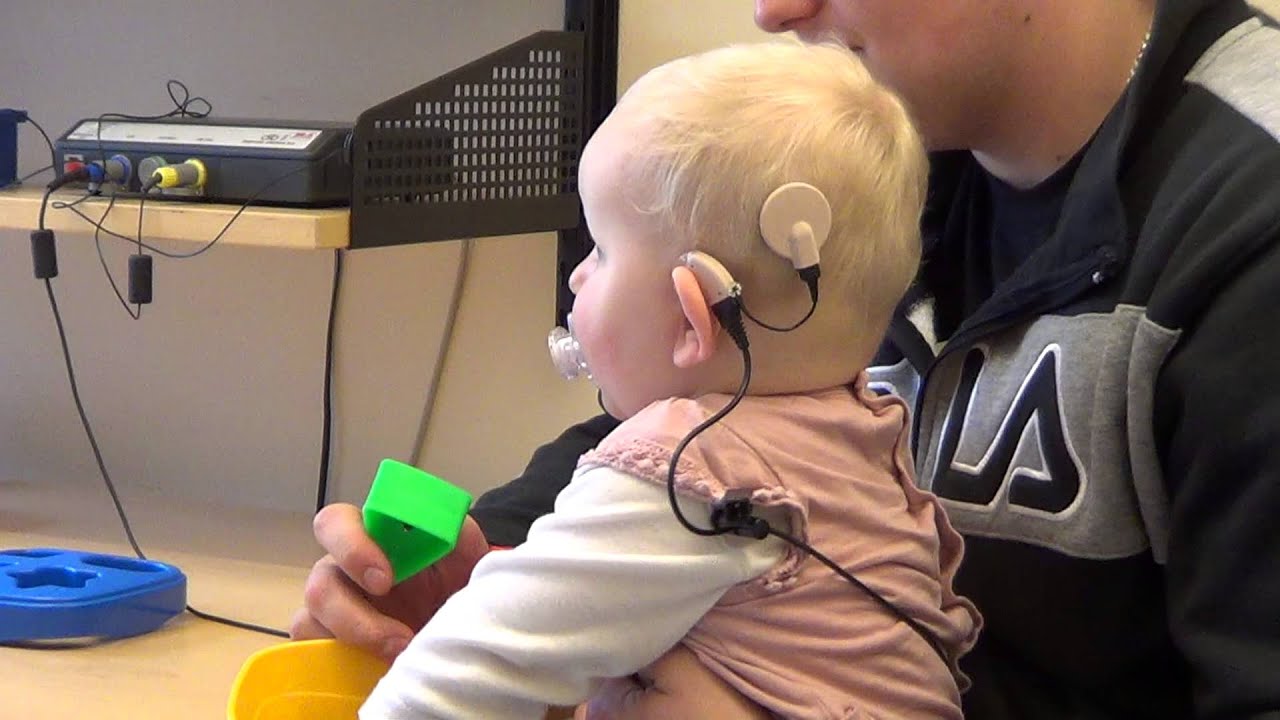 Hear for the first time with Cochlear implants - YouTube