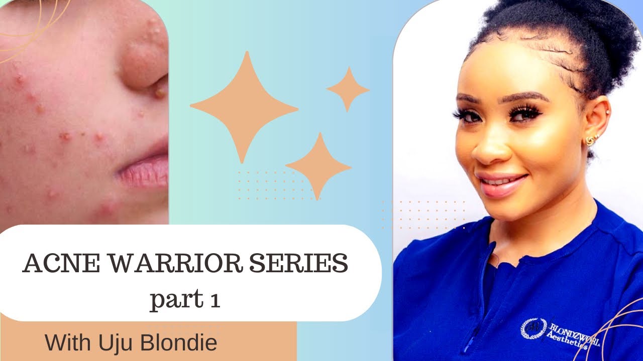 ACNE WARRIOR SERIES PART 1 : Overview of acne. - YouTube