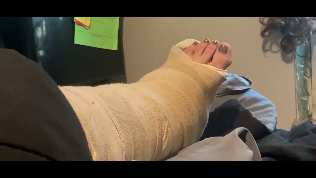 Sprained ankle , Ankle splint - YouTube