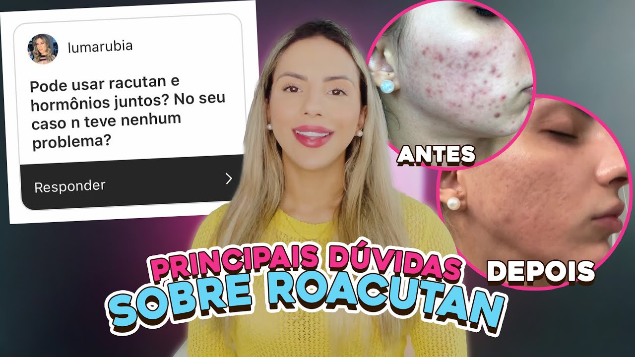 MINHA EXPERIÊNCIA USANDO ROACUTAN | PODE USAR HORMÔNIOS DURANTE O ...