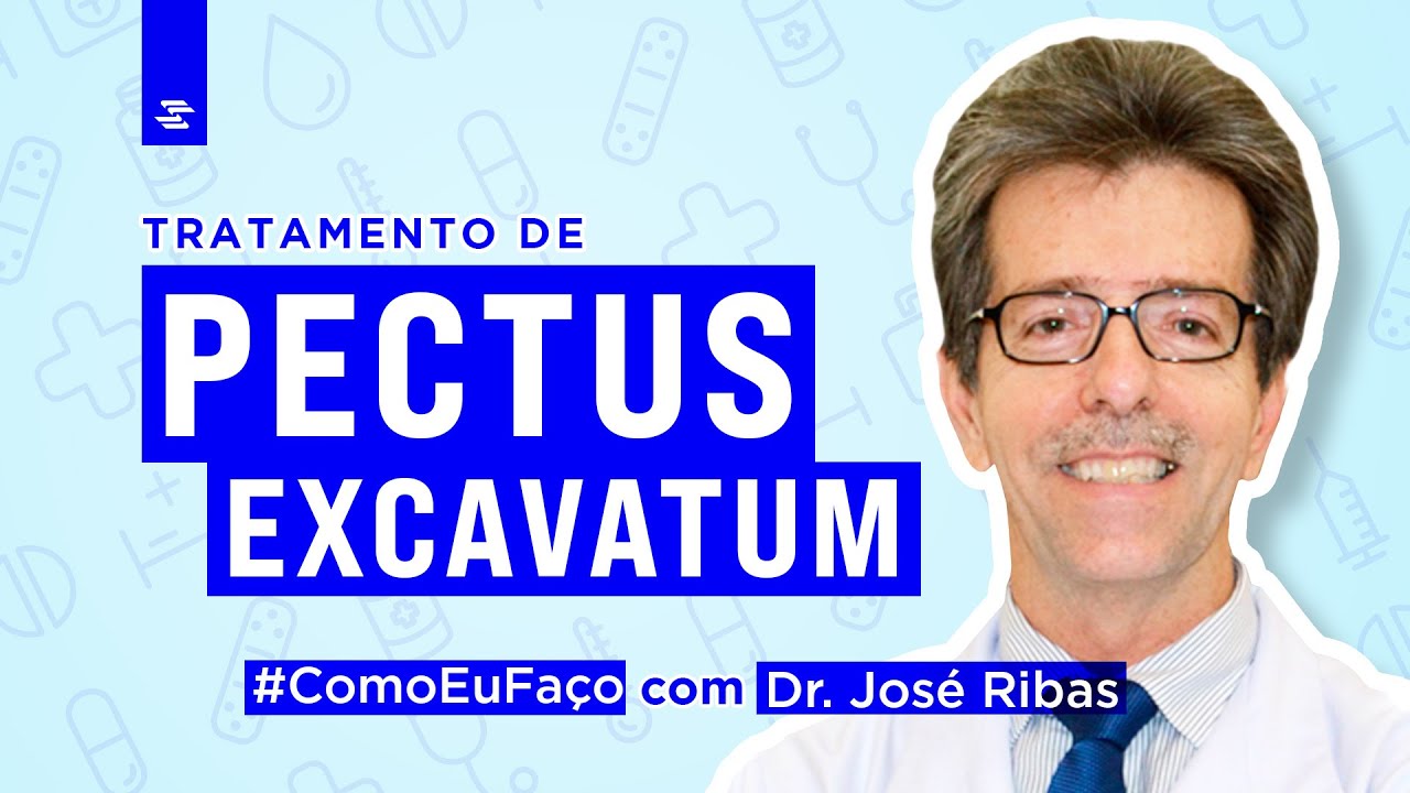 Como Eu Faço: Tratamento do Pectus Excavatum com Pectus Press por Dr ...