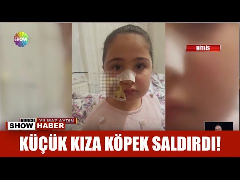 Küçük kıza köpek saldırdı!