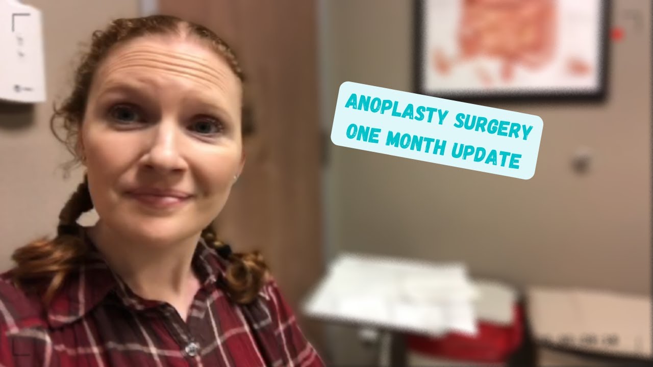 Anoplasty Surgery One Month Update - YouTube