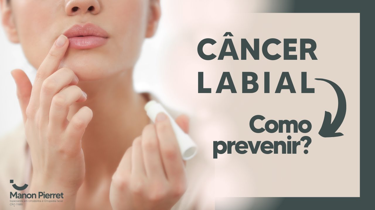 Prevenção do câncer labial: Como se proteger - YouTube