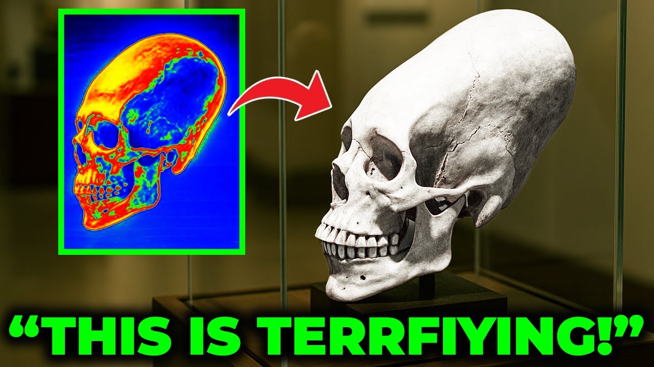 Peru's 3,000-Year-Old Elongated Skull Mystery Finally Solved By AI And ...