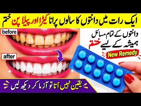 Deeth cleaning worlds best remedy/white ur yellow teeth in just 2 minutes/best teeth cleaning remedy