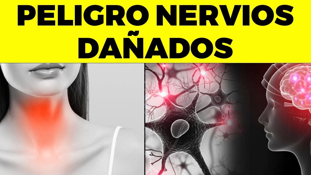 ¡ALERTA! Por Esta Razón tienes los Nervios Dañados, Esto Afecta A Tus ...