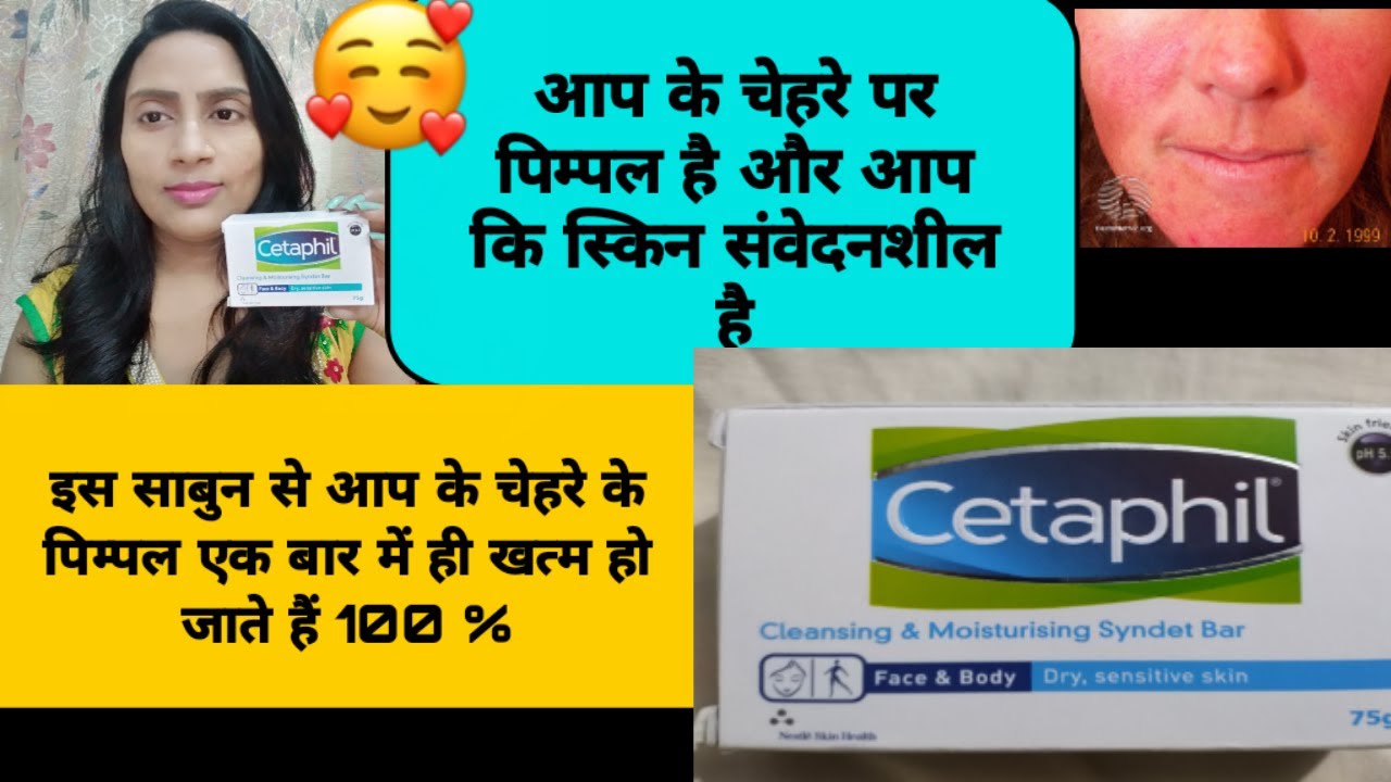 Cetaphil Cleasning & Moisturising Syndet Bar For Face & Body of Dry ...