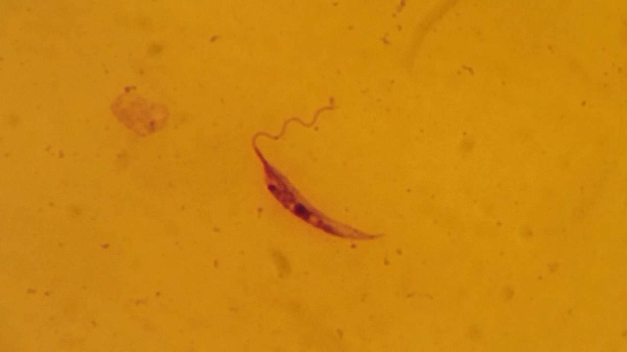 Leishmania donovani promastigote form - YouTube