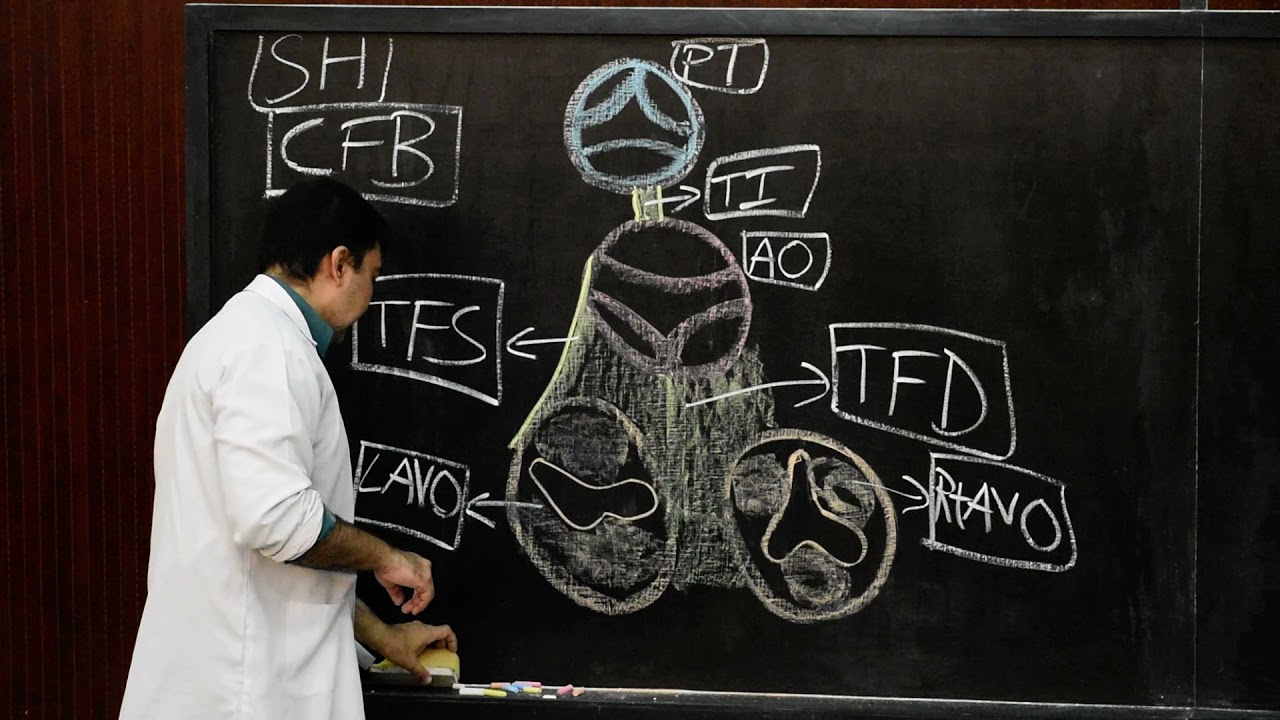 Gross anatomy of fibrous skeleton of the heart - 1 - YouTube