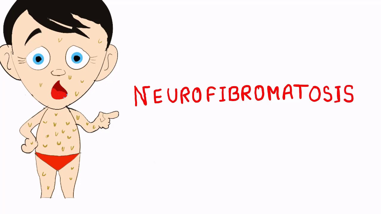 Neurofibromatosis - type 1 and type 2 - YouTube