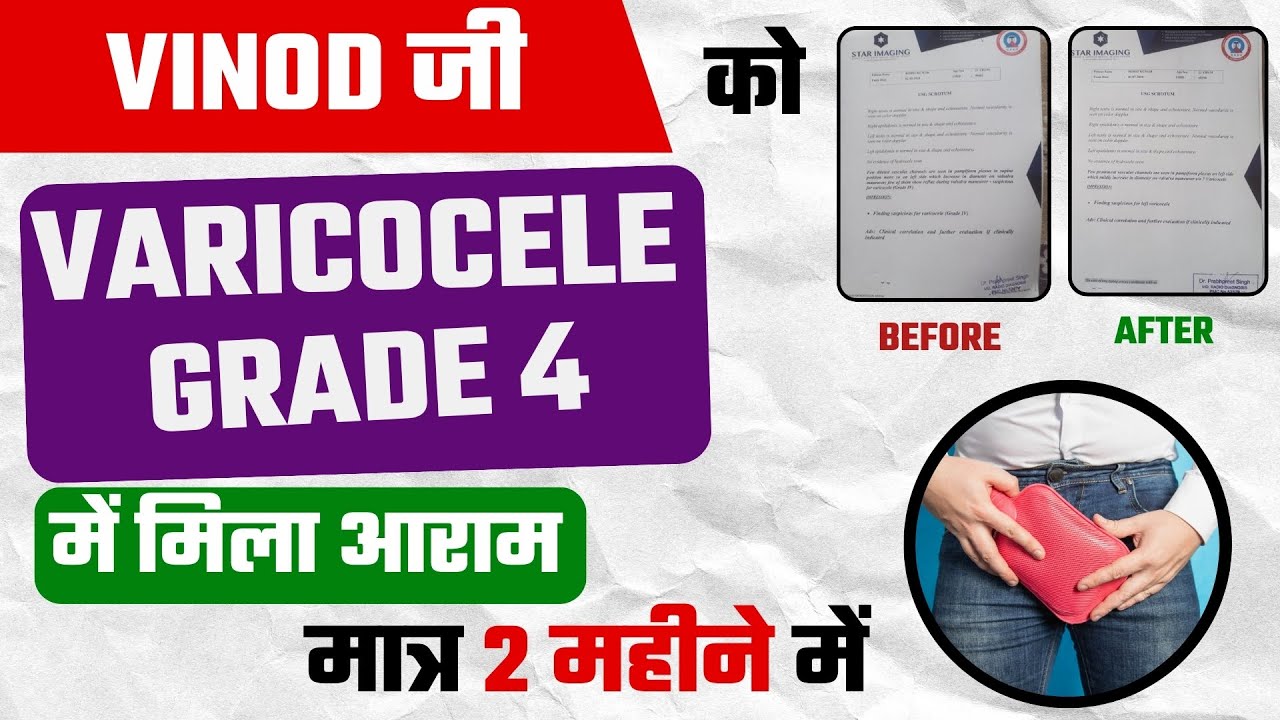 Rohit को Grade 4 Varicocele में मिला चमत्कारी आराम | Bharat Homeopathy ...