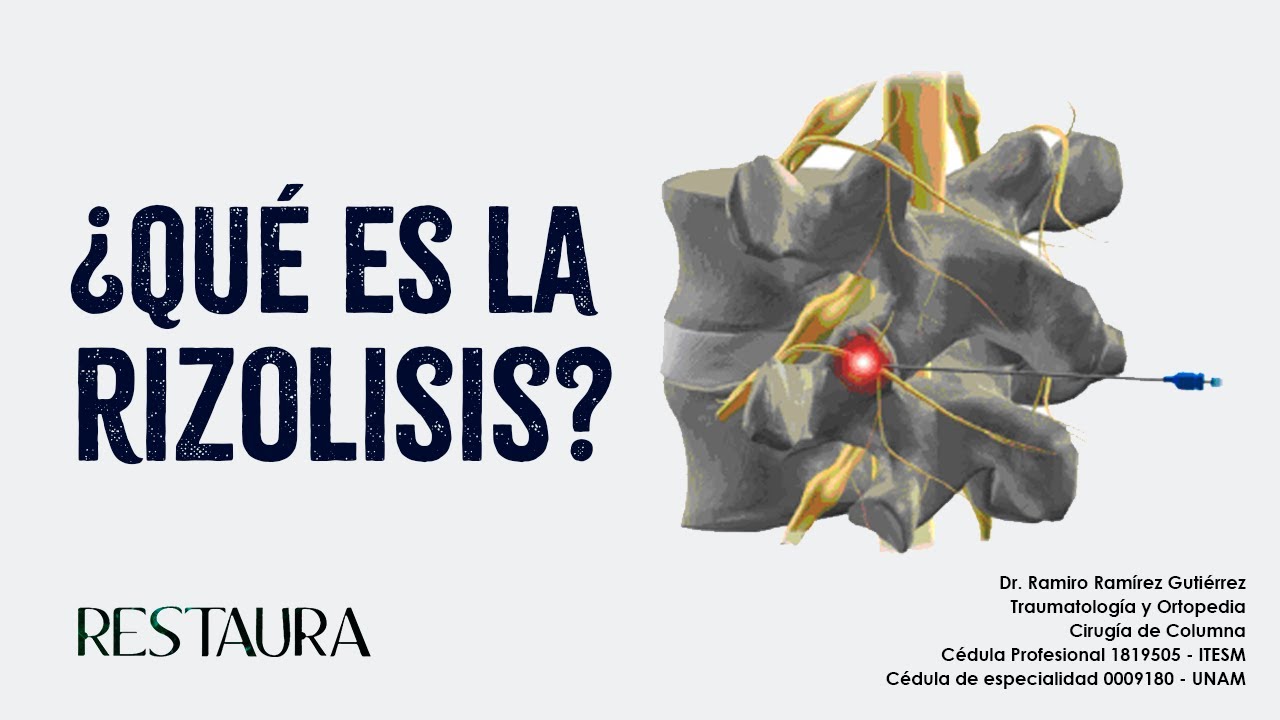 ¿Qué es la Rizolisis? - YouTube