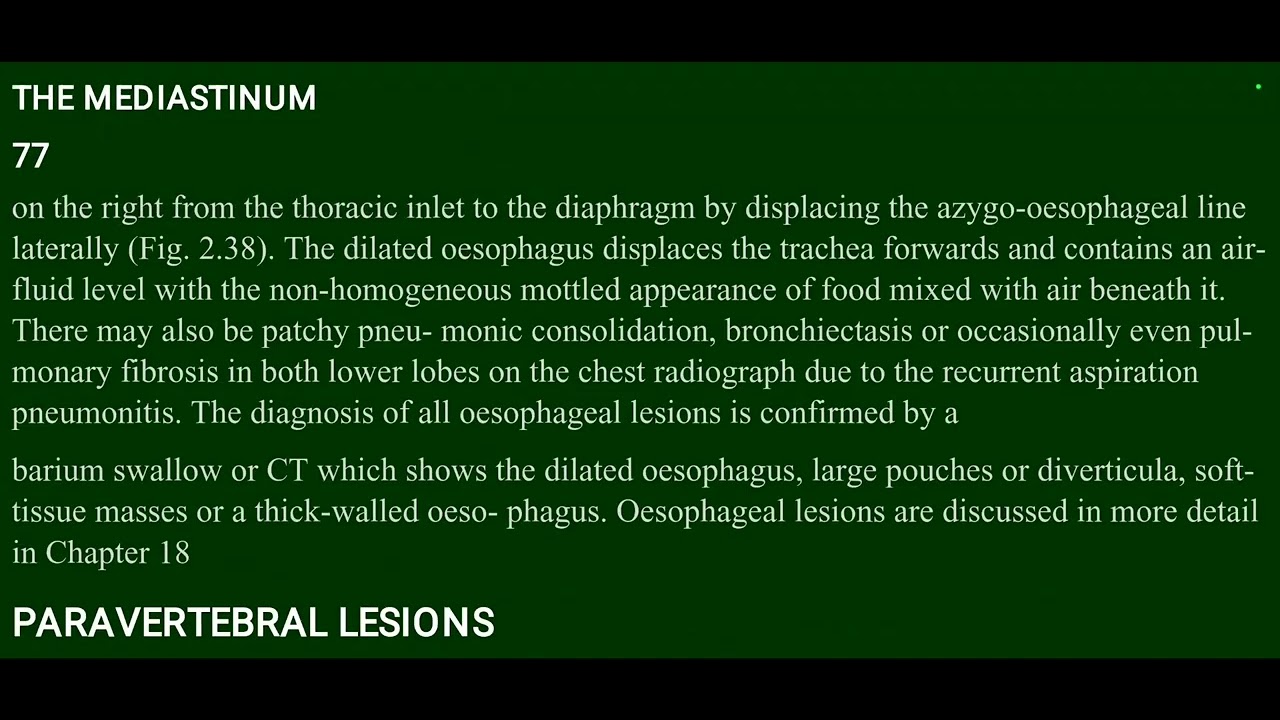 SUTTON MEDIASTINUM CHAPTER IMAGES ONLY@Mamdouh Mahfouz @CTisus @Indian ...