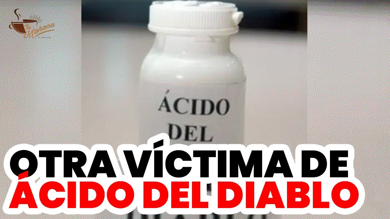 Otra mujer resulta víctima de “ácido del diablo” por expareja | Tu ...