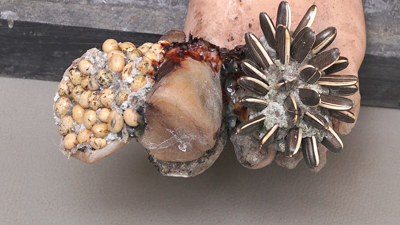 Amazing Toenails, Too Thick, Trim Them Slowly 👣 Professional pedicure ...