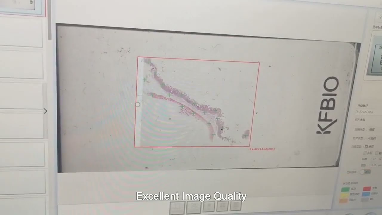 KFBIO 400 Slides Digital pathology scanner - YouTube