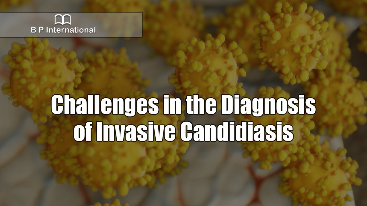 Challenges in the Diagnosis of Invasive Candidiasis - YouTube
