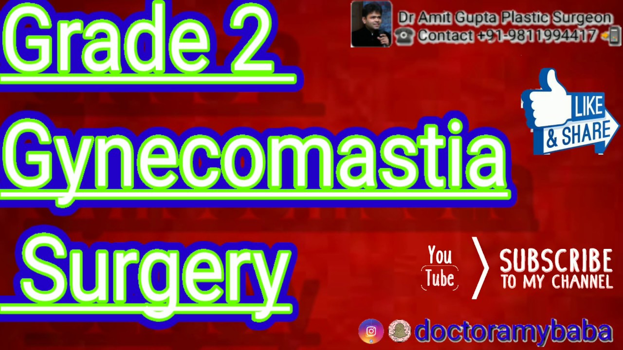 Grade 2 Gynecomastia Surgery - YouTube