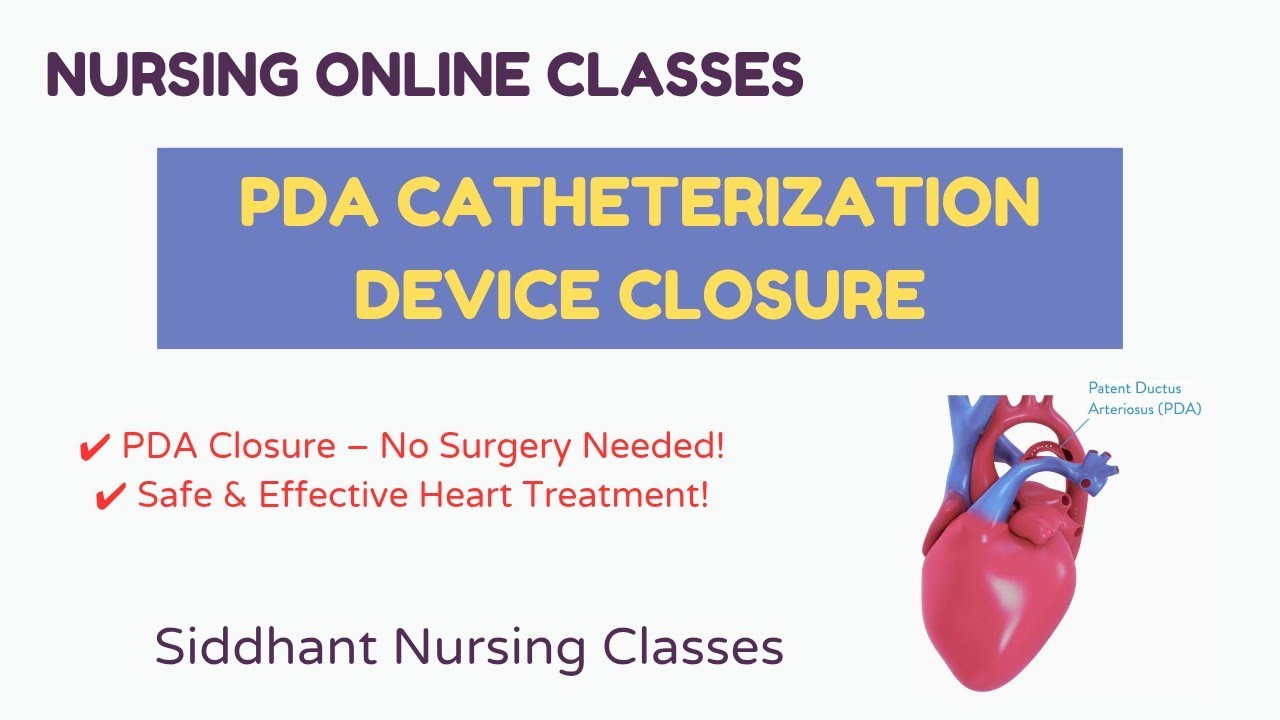 PDA Closure Without Surgery! Safe & Effective Heart Treatment - YouTube