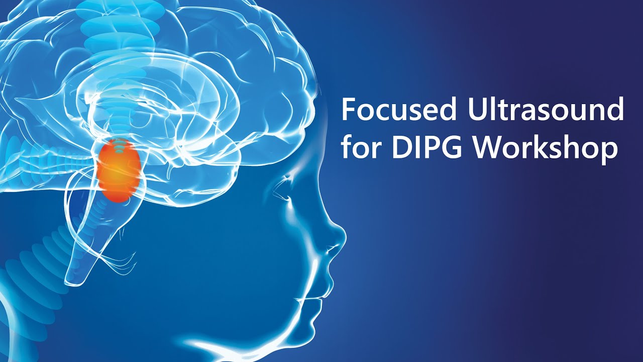 Focused Ultrasound for Diffuse Intrinsic Pontine Glioma (DIPG) Workshop ...