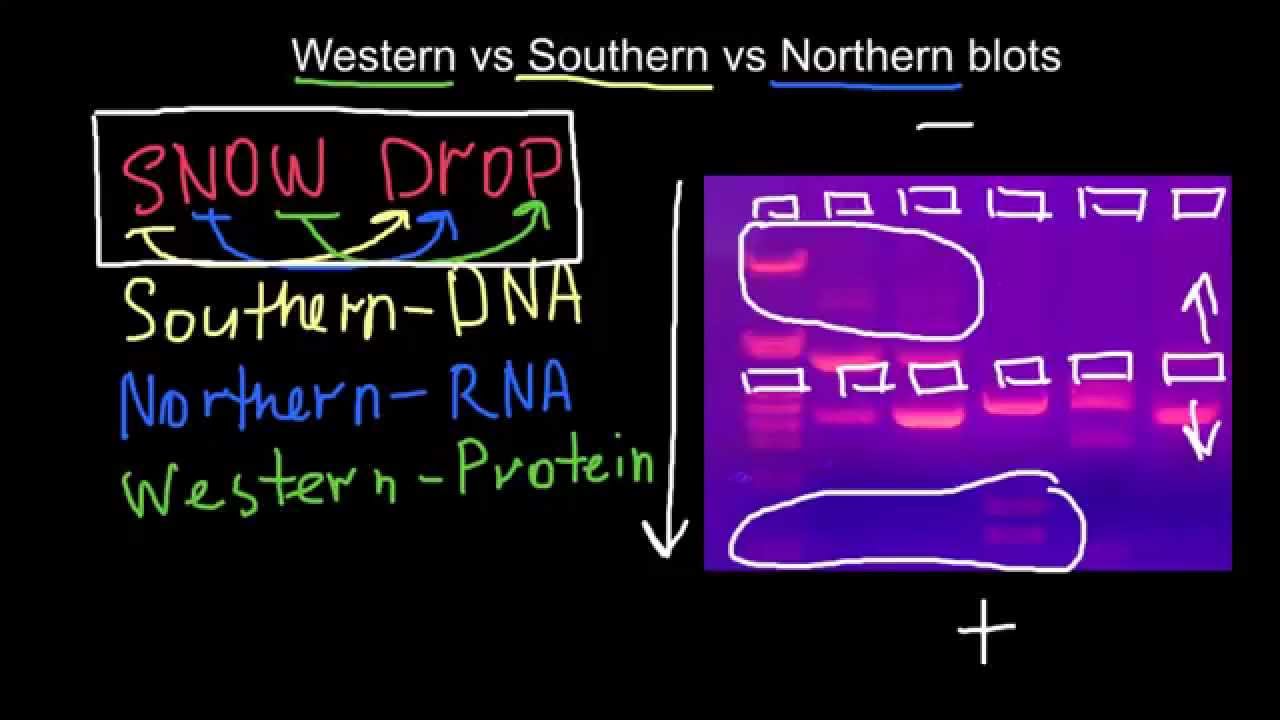 Western vs Southern vs Northen blots - mnemonic technique to memorize ...