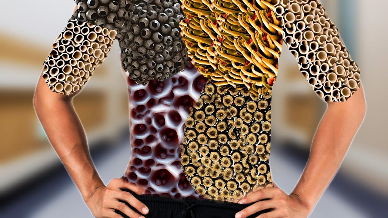 ASMR removal bryozoan maggot infected of body | ASMR chest shoulder ...