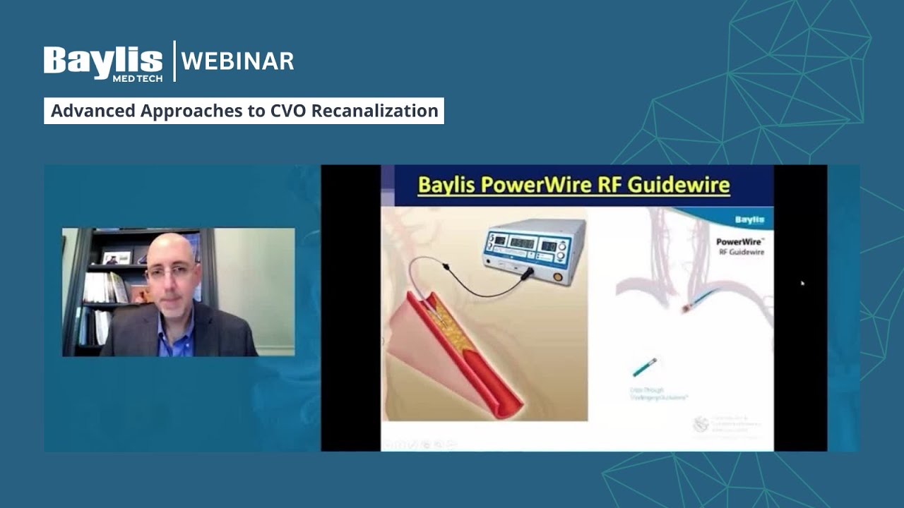 Advanced Approaches to Central Venous Occlusions Recanalization ...