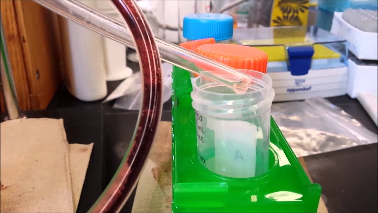 Artificial kidney prototype produces urine in the lab - YouTube
