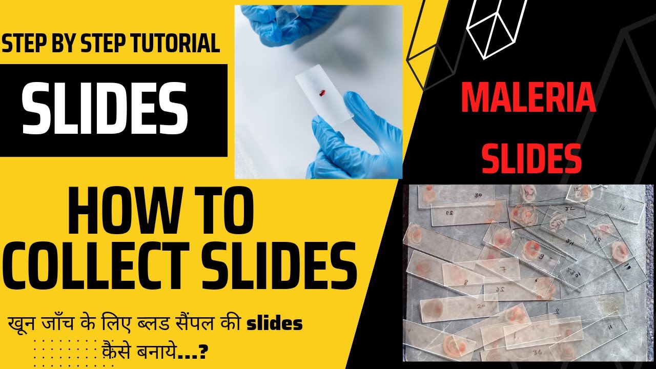 || BLOOD SAMPLE SLIDES कैसे collect करे..?||…|| HOW TO COLLECT BLOOD ...