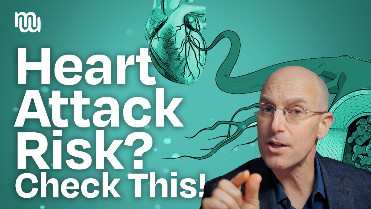 Early Heart Disease Detection? Why You May Consider a CIMT Test - YouTube
