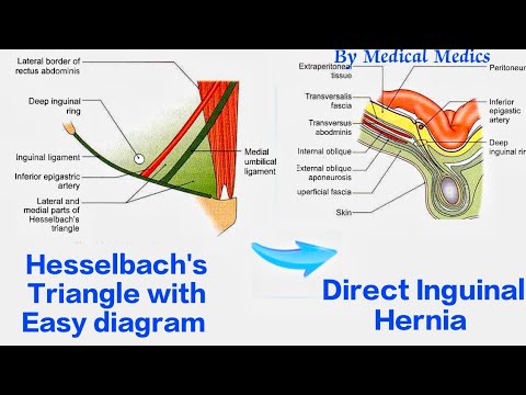 Hesselbach's Triangle || Anatomy of Inguinal Triangle Simplified ...