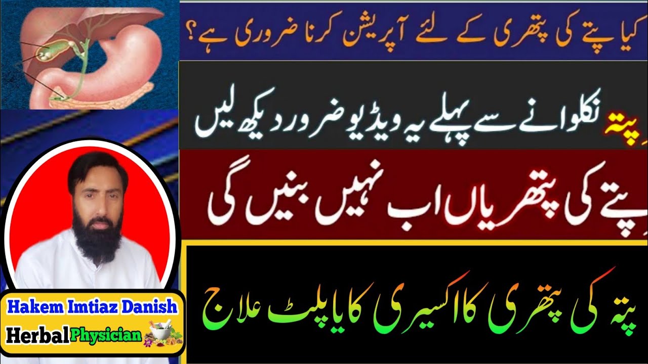 Gall bladder Stone SymptomsTreatment || Pita ki pathri ka ilaj in urdu ...